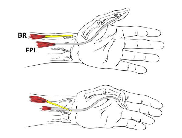 A Simulation Analysis of the Combined Effects of Muscle Strength and ...