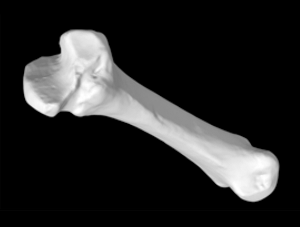 The Parametric Human Project: Building a Probabilistic Atlas of Human Anatomy